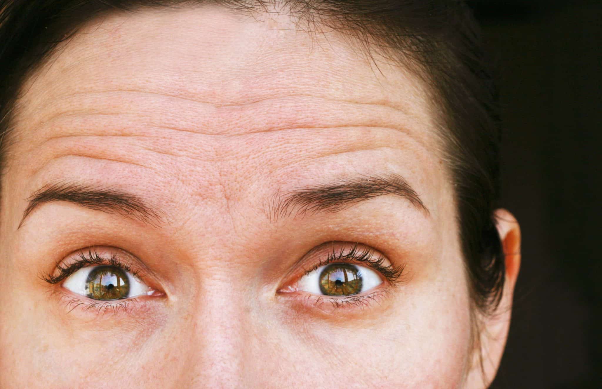 How Does Botox Work for Wrinkles? - The Bar Aesthetics & Wellness
